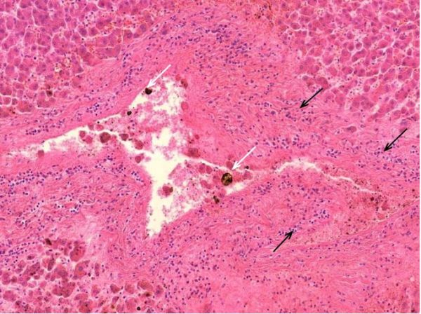 Report 100: Pathological Basis of CoVax Disease Cardiovascular ...